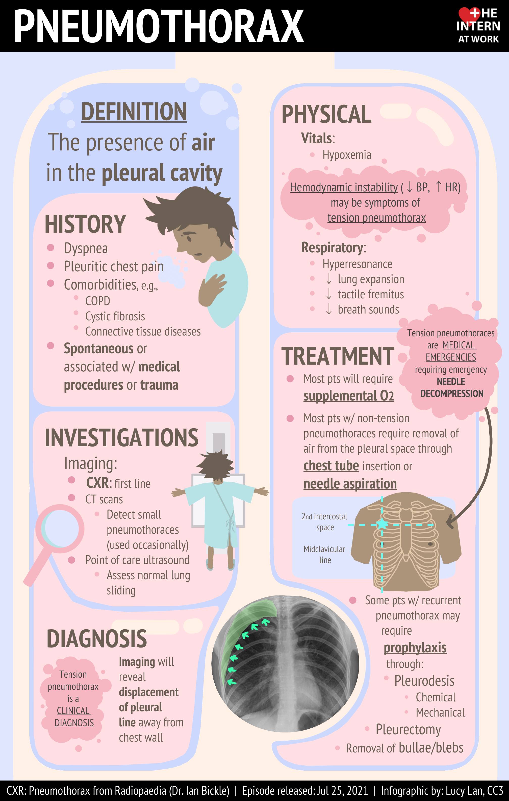 Approach to Pneumothorax - Medicine Pods